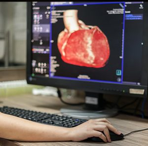 CT Coronary angiogram (CTCA) – Heart and Beyond